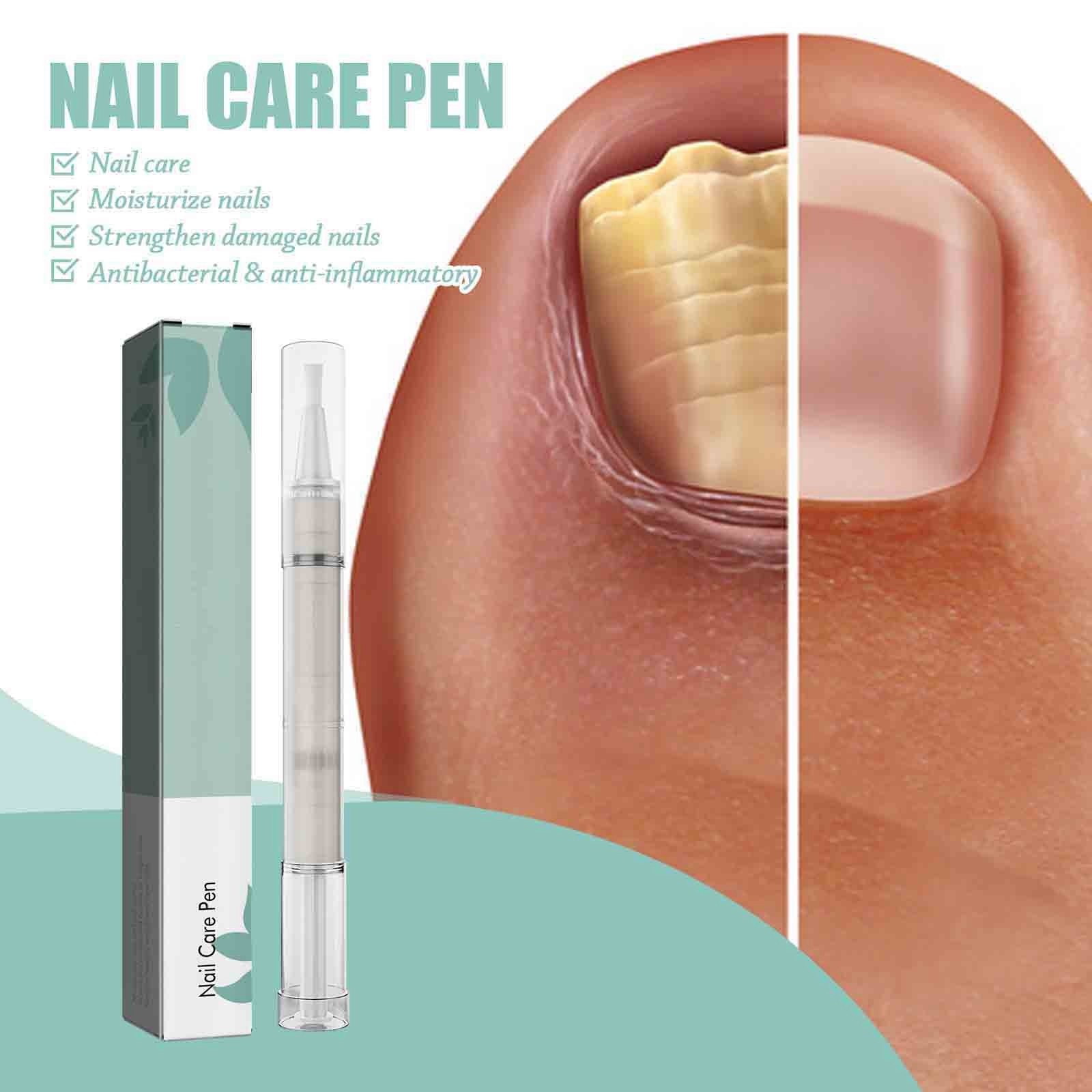 Nail Pen Onychomycosis Care Solution Cleansing And Thickening ... Nail Pen Onychomycosis Care Solution Cleansing And Thickening ...